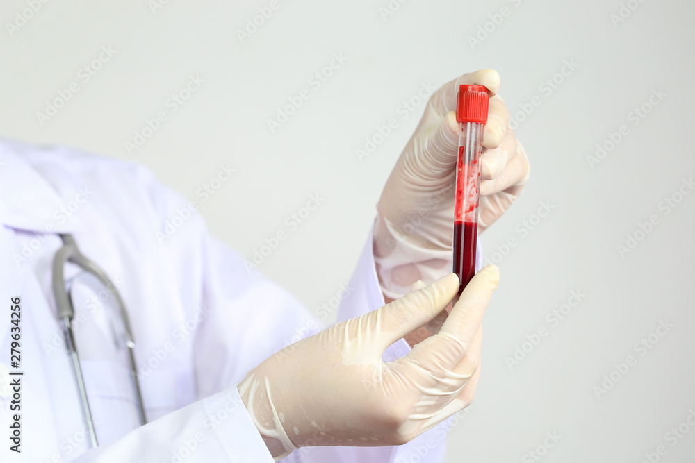 Doctor hand holding blood collection tubes in hematology laboratory ...