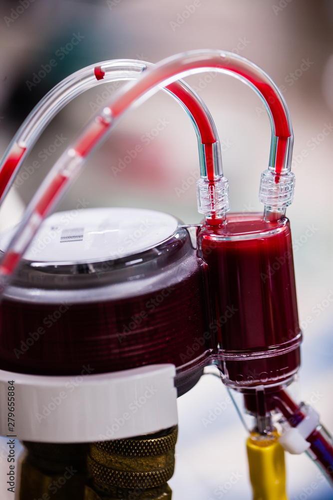 cardiotomy reservoir of oxygenator is a part of heart lung machine ...