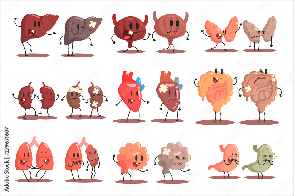 Human Internal Organs Healthy Vs Unhealthy Set Of Medical Anatomic ...