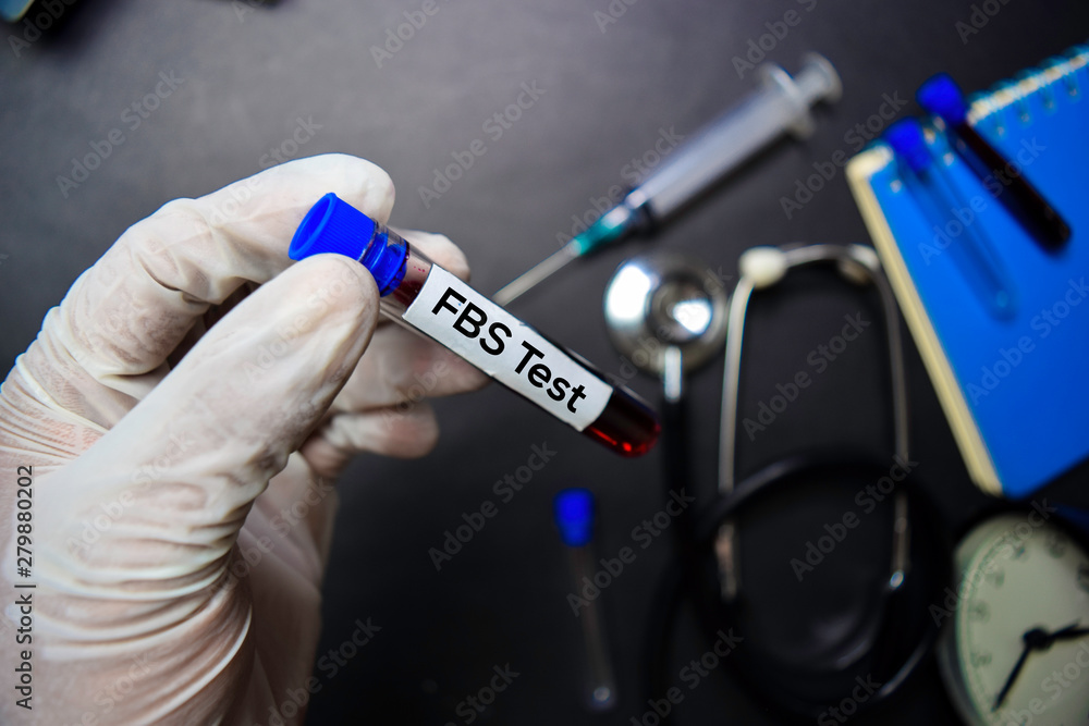 FBS Test text with blood sample. Top view isolated on black background ...