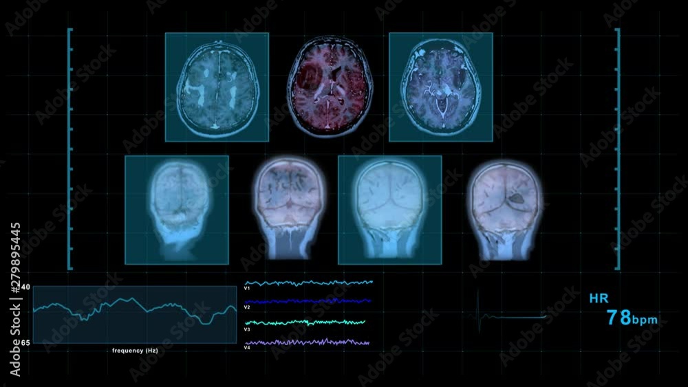Futuristic HUD Medicine Screen Data. Scanning of human brain activity ... Futuristic HUD Medicine Screen Data. Scanning of human brain activity ...
