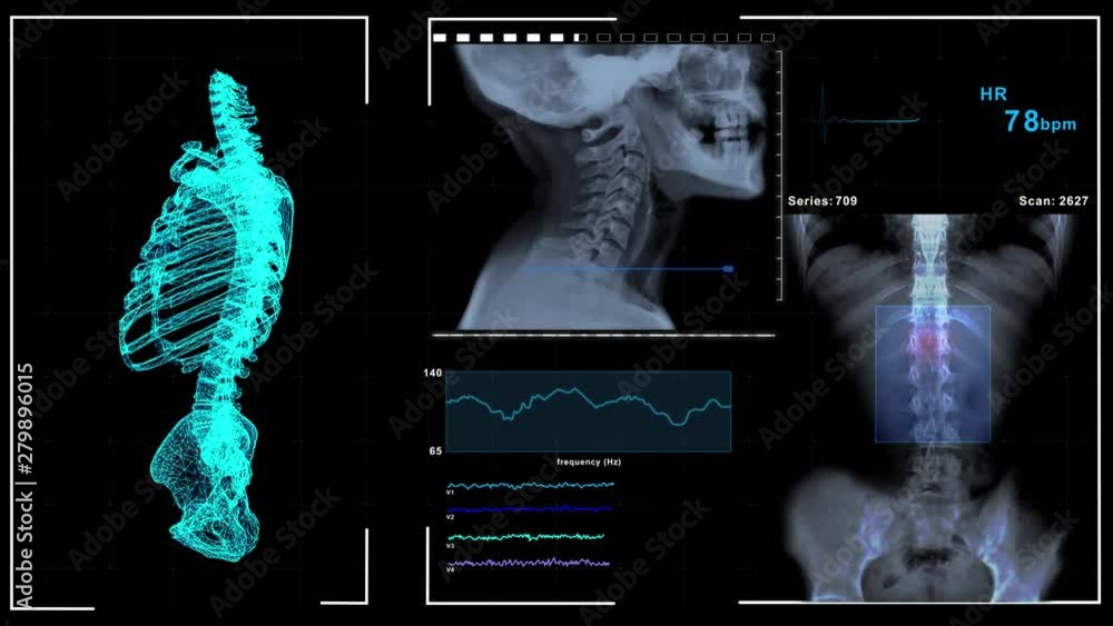 Futuristic HUD Medicine Screen Data. 3D animation, scanning of human ... Futuristic HUD Medicine Screen Data. 3D animation, scanning of human ...