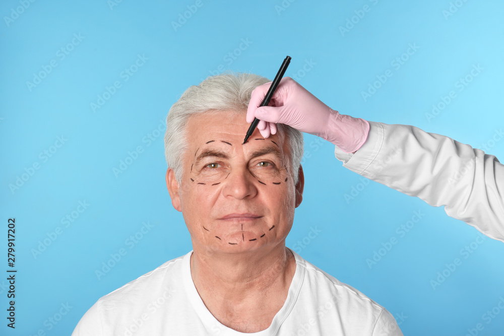 Doctor drawing marks on man's face for cosmetic surgery operation ...