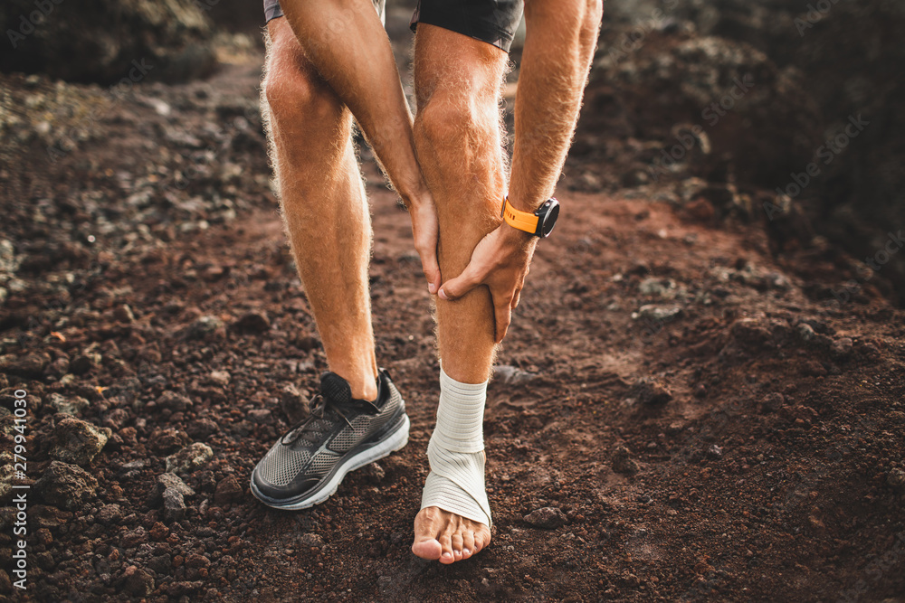 Male runner holding injured leg close-up and suffering with pain. Leg ...