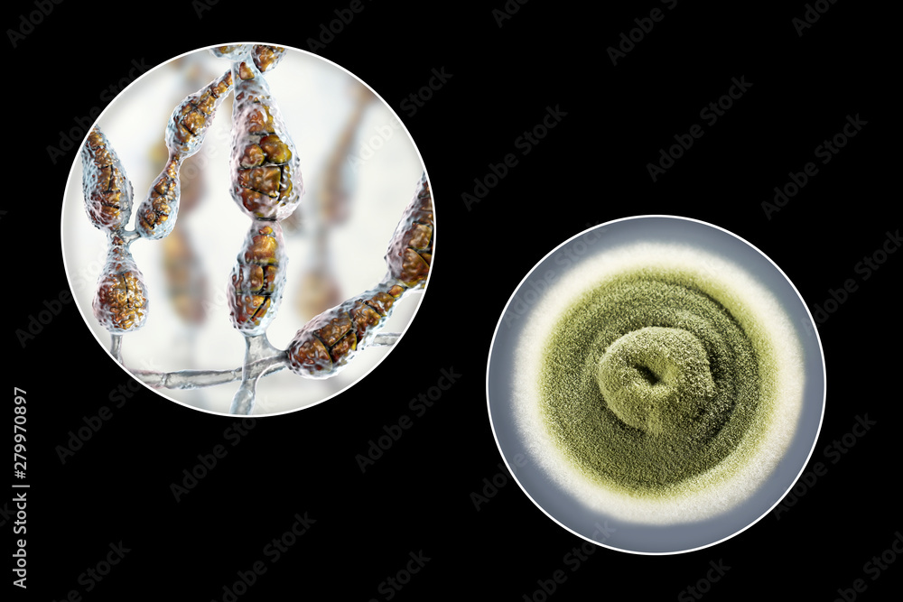 Mold Alternaria alternata, allergic fungus, 3D illustration and photo ...