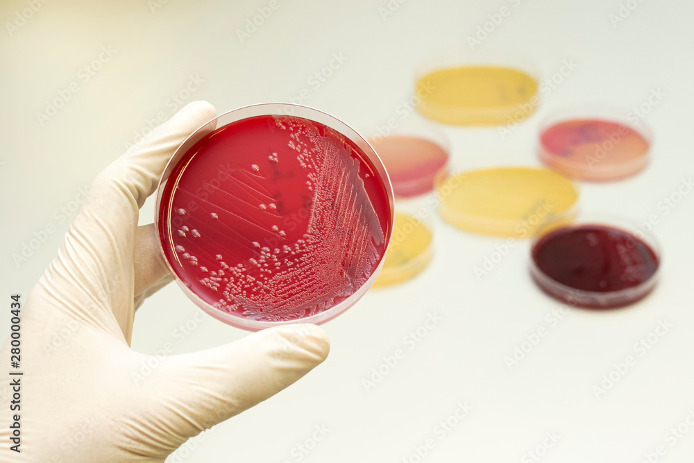 Foto de Hand holding petri dish with Escherichia coli (E. coli) culture ...