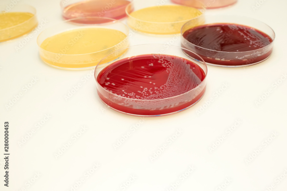 Escherichia coli (E. coli) culture in petri dish with macconkey agar ...
