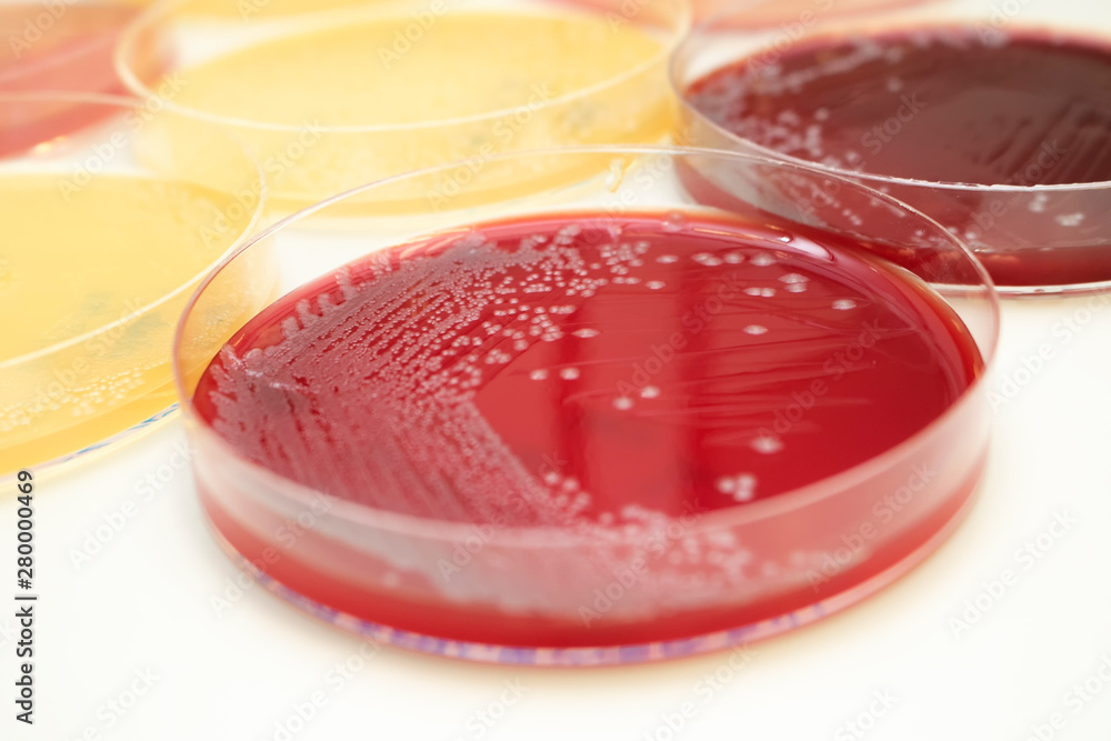 Escherichia coli (E. coli) culture in petri dish with macconkey agar ...