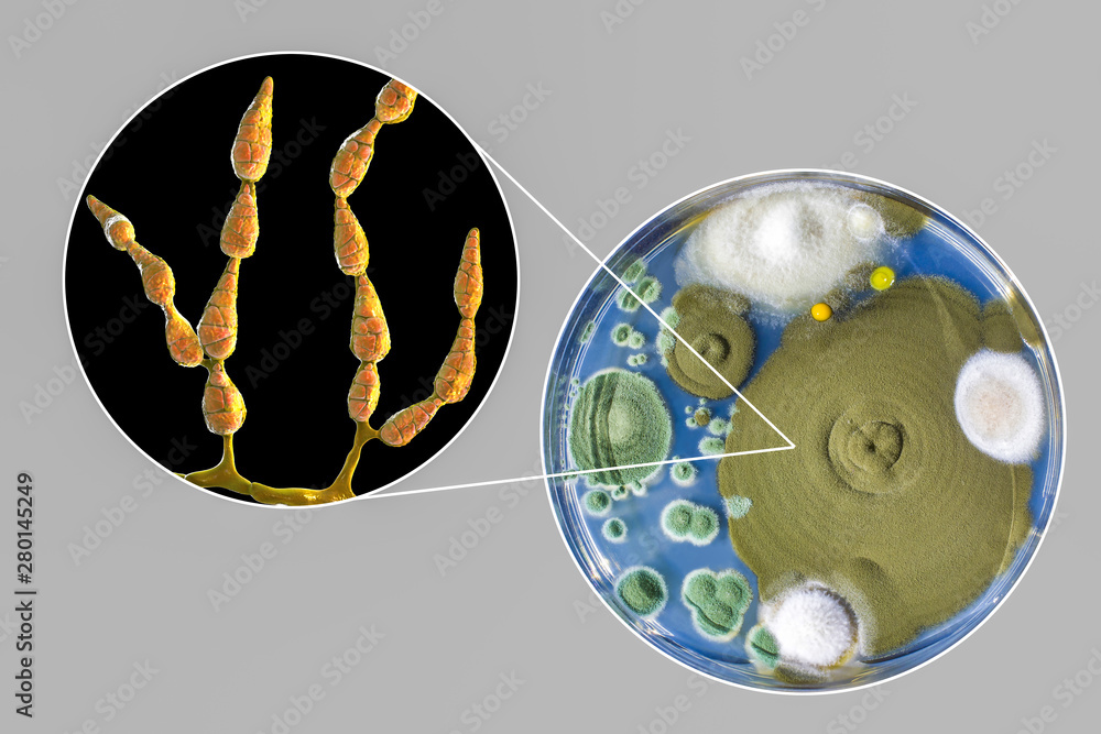 Mold Alternaria alternata, allergic fungus, 3D illustration and photo ...