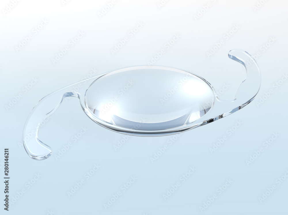 Intraocular lens (IOL). Medical 3D illustration on light bue background ...