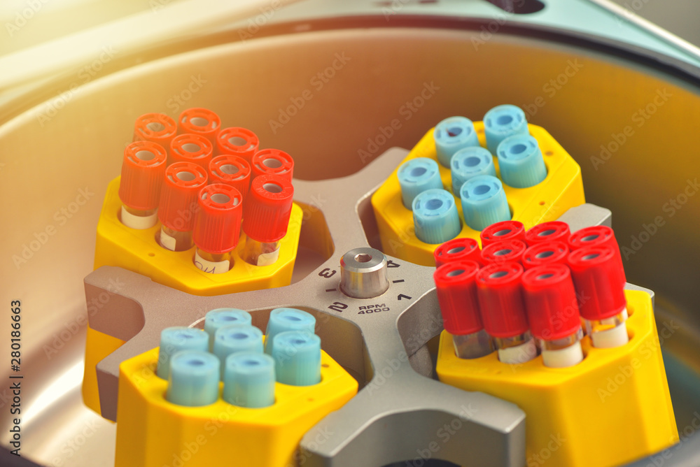 Tubes of blood sample for testing in a spin. Medical equipment Stock ...