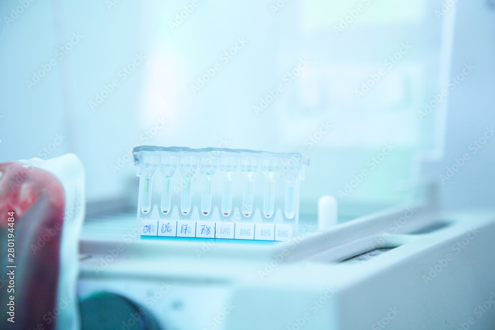 Laboratory testing.compatibility between donor blood and patient blood ...