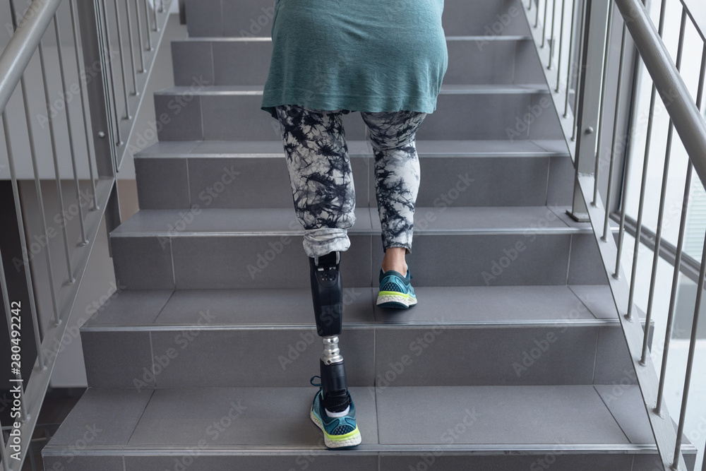 Disabled female patient with prosthetic leg walking on stairs in ...