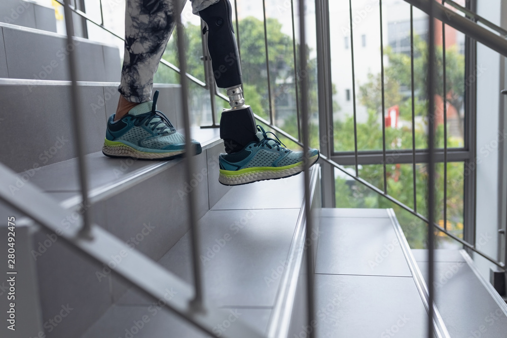 Disabled female patient with prosthetic leg walking on stairs in ...