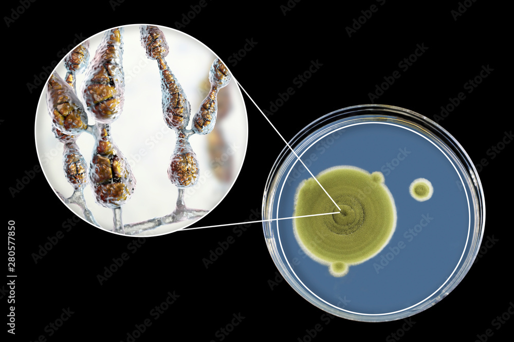Mold Alternaria alternata, allergic fungus, 3D illustration and photo ...