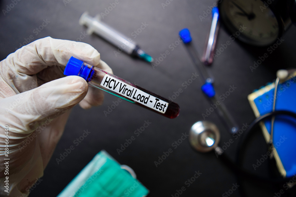 HCV Viral Load - Test with blood sample. Top view isolated on black ...