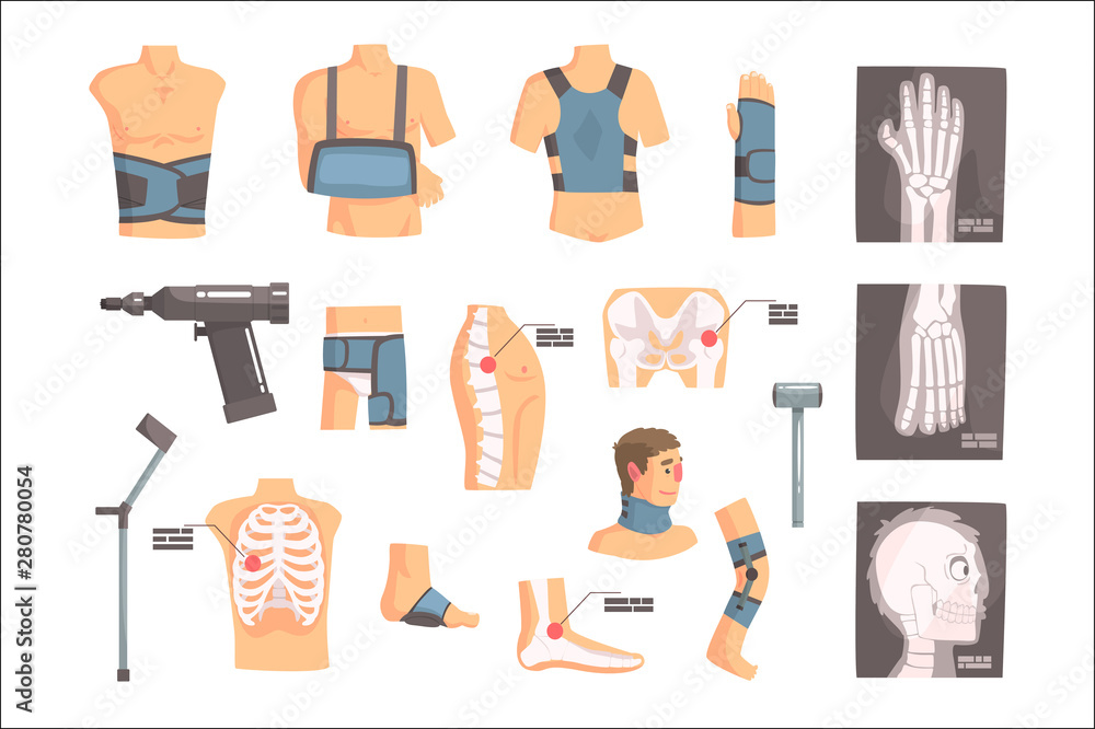 Orthopedic Surgery And Orthopaedics Attributes And Tools Set Of Cartoon ...