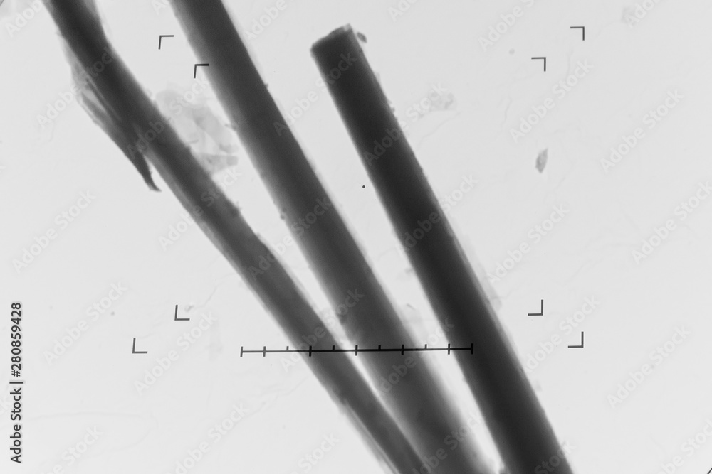 Environmental laboratory, anthophyllite fibers (asbestos variety) seen ...