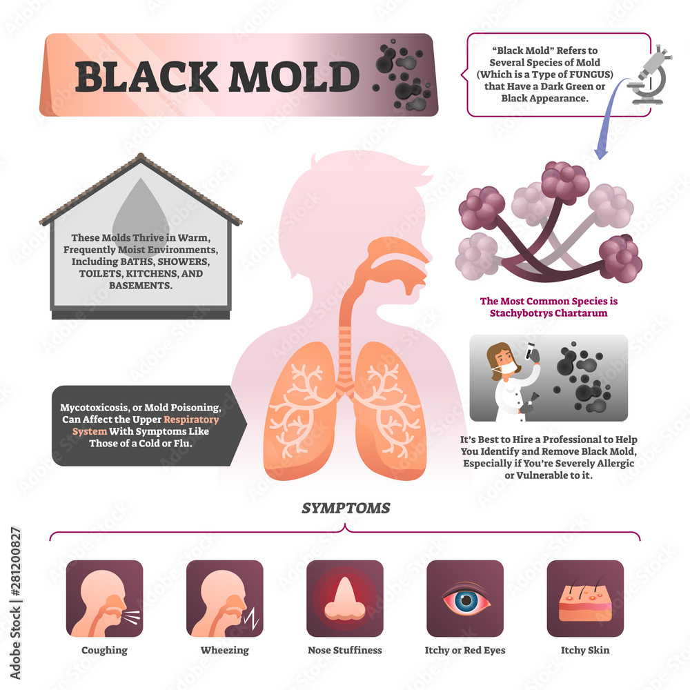 Black mold vector illustration. Labeled symptom and description ...