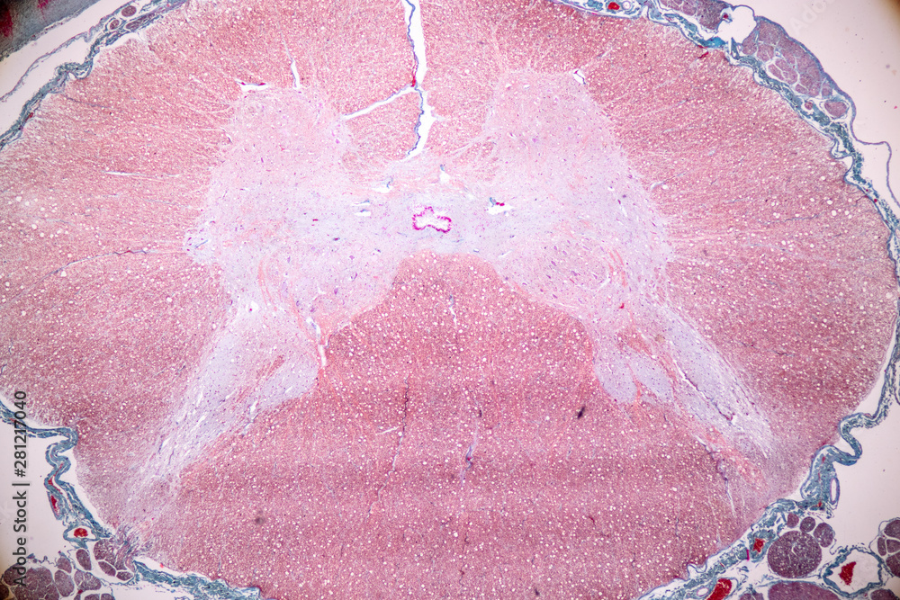 Education anatomy and Histological sample Spinal cord Tissue under the ...