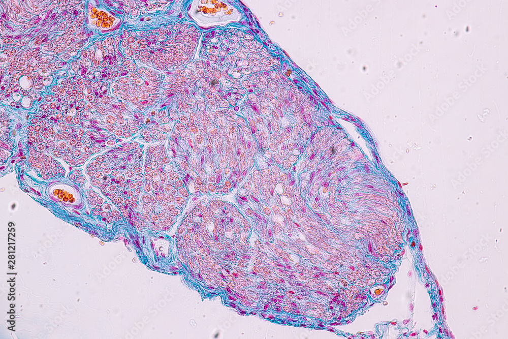 Education anatomy and Histological sample Spinal cord Tissue under the ...