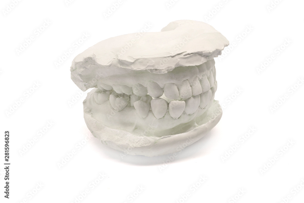 Dental model plaster on white background,isolated.Plaster model jaw ...