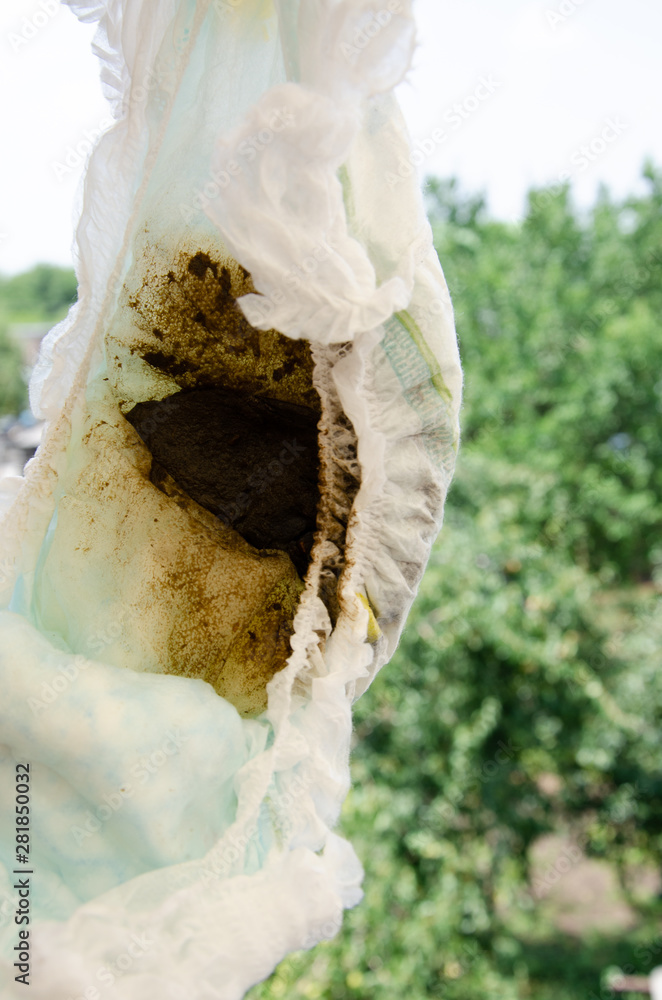 dirty diaper with poop on a white background in hands and close Stock ...