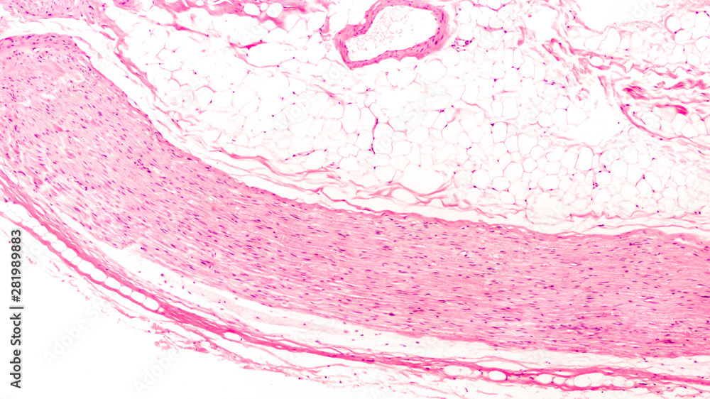 Foto Stock Histology of a peripheral nerve in longitudinal section, composed of bundles of ...
