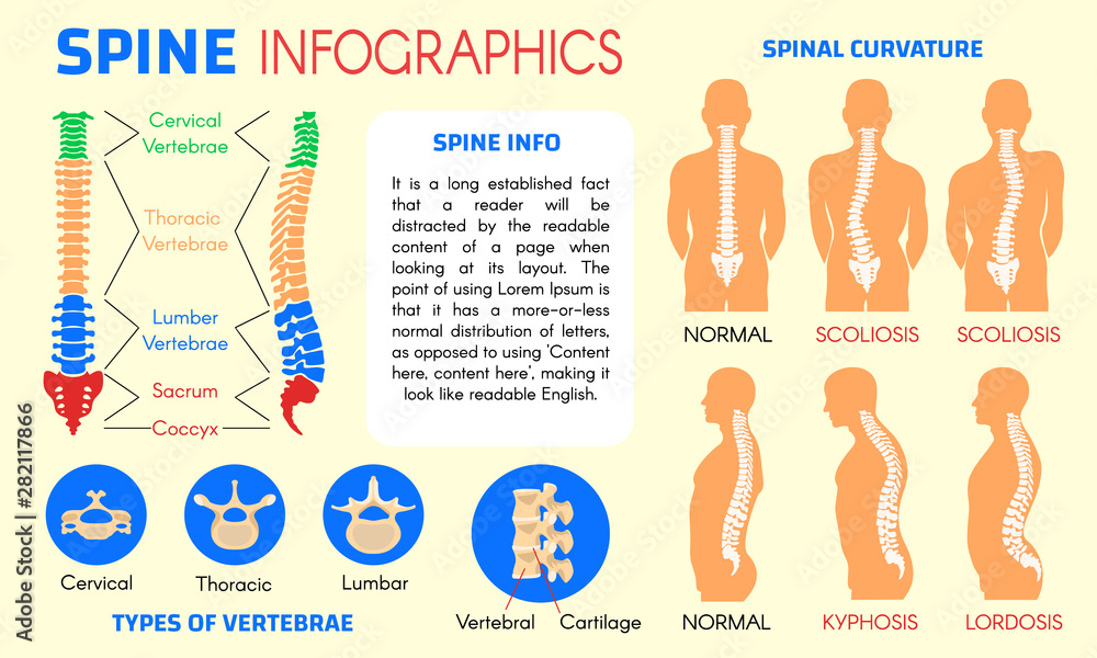 Human spine infographic. Flat illustration of human spine vector ...