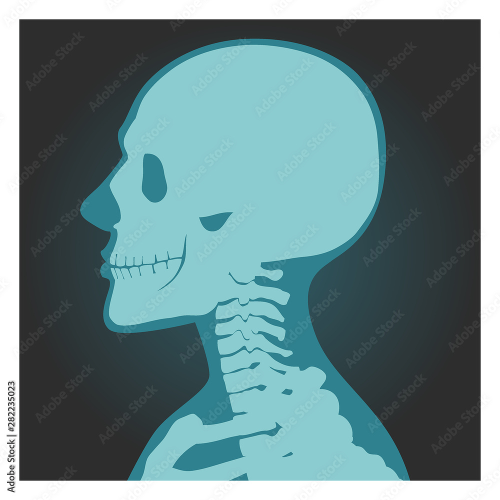 X-ray shot of skull, human body, head and neck bones side view ...