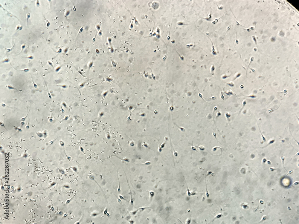 View at human sperm under microscope in lab Stock Photo | Adobe Stock