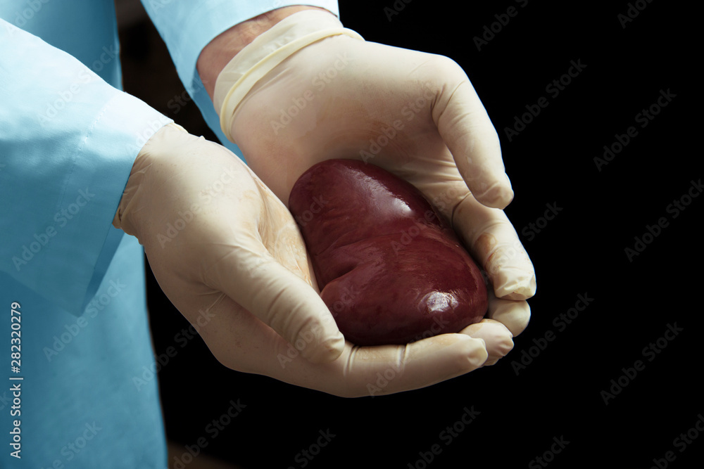 kidney transplant surgery concept. real kidney is in hands of ...