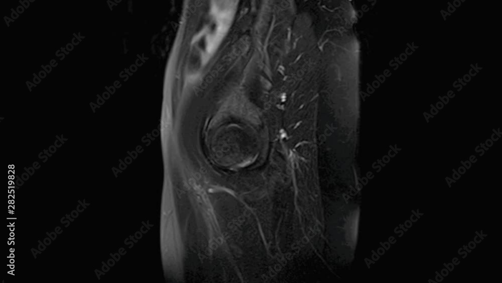 Contrast MRI scan of the abdominal cavity and retroperitoneal space ...