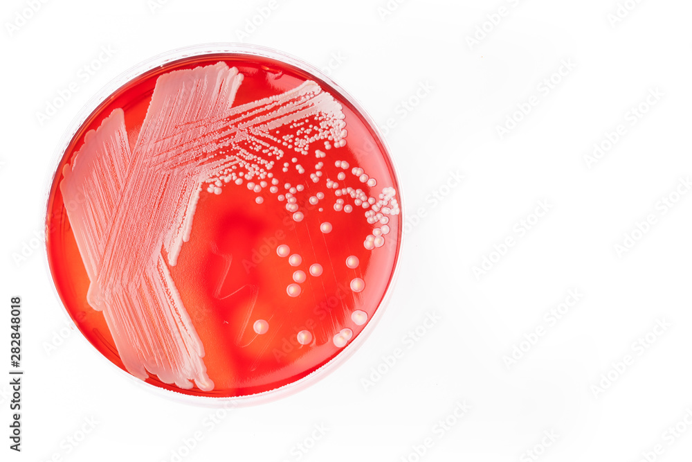 Staphylococcus aureus - bacterial cultures. White background Stock ...