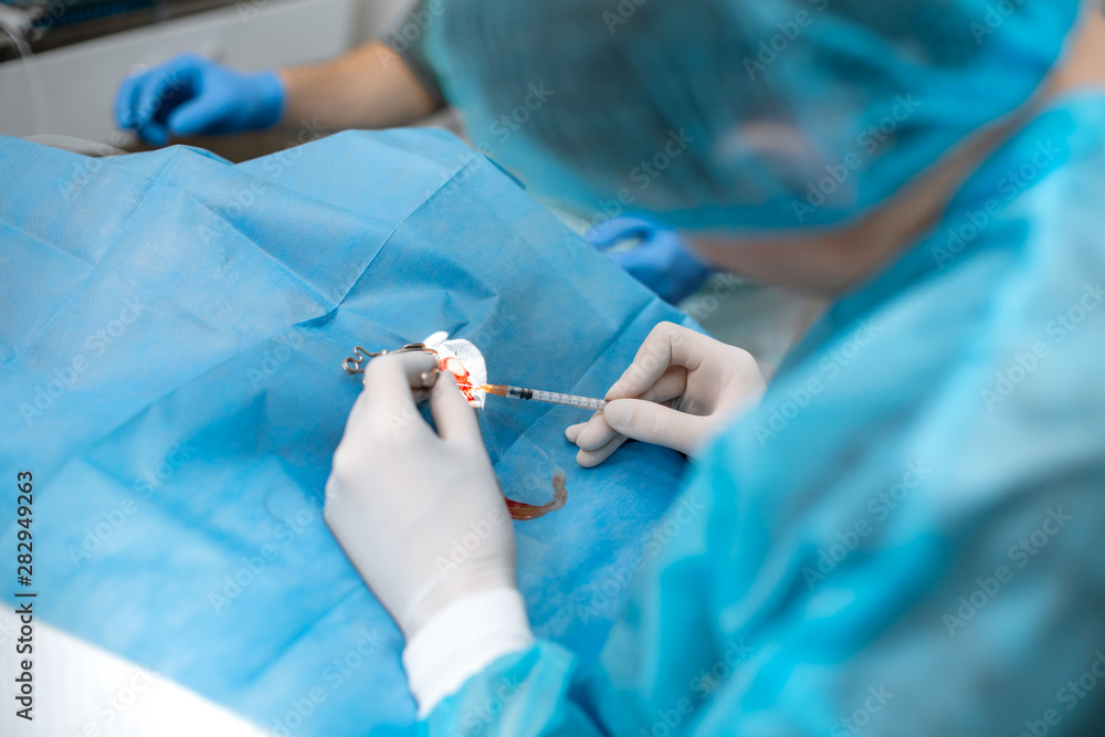 A professional ophthalmologist performs eye surgery with a microscope ...