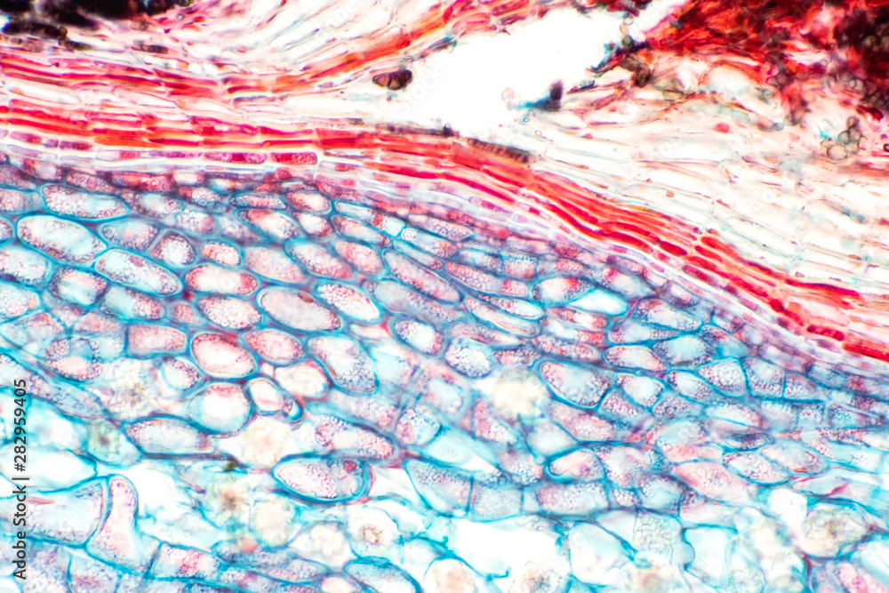 Foto Stock Cross sections of plant stem under microscope view show ...