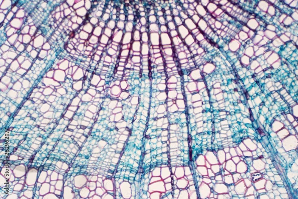 Cross section - Xylem is a type of tissue in vascular plants that ...