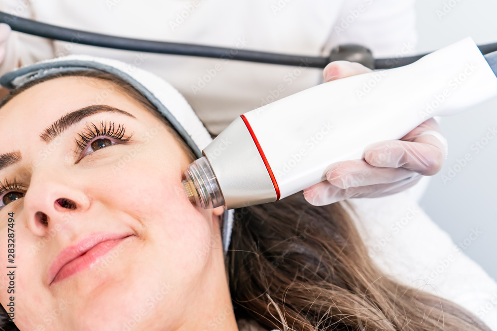 Radio frequency microneedling machine handpiece on the cheek of a woman ...