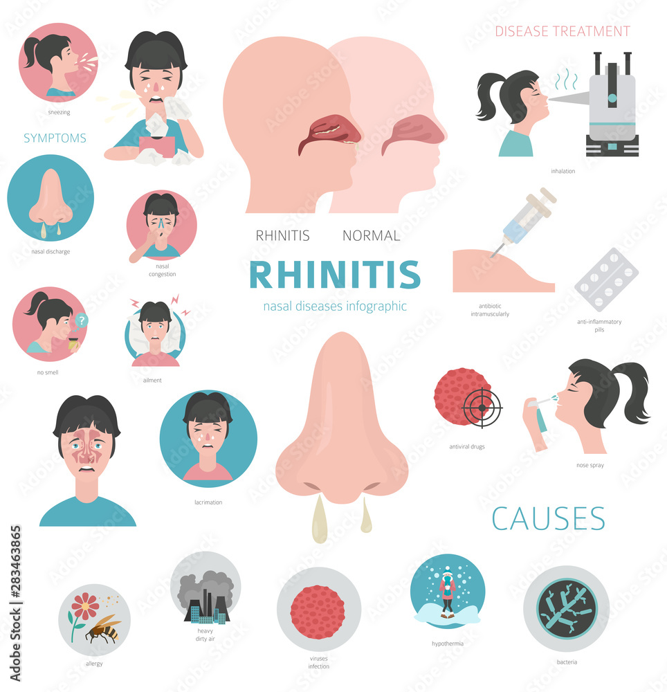 Nasal diseases. Rhinitis symptoms, treatment icon set. Medical ...