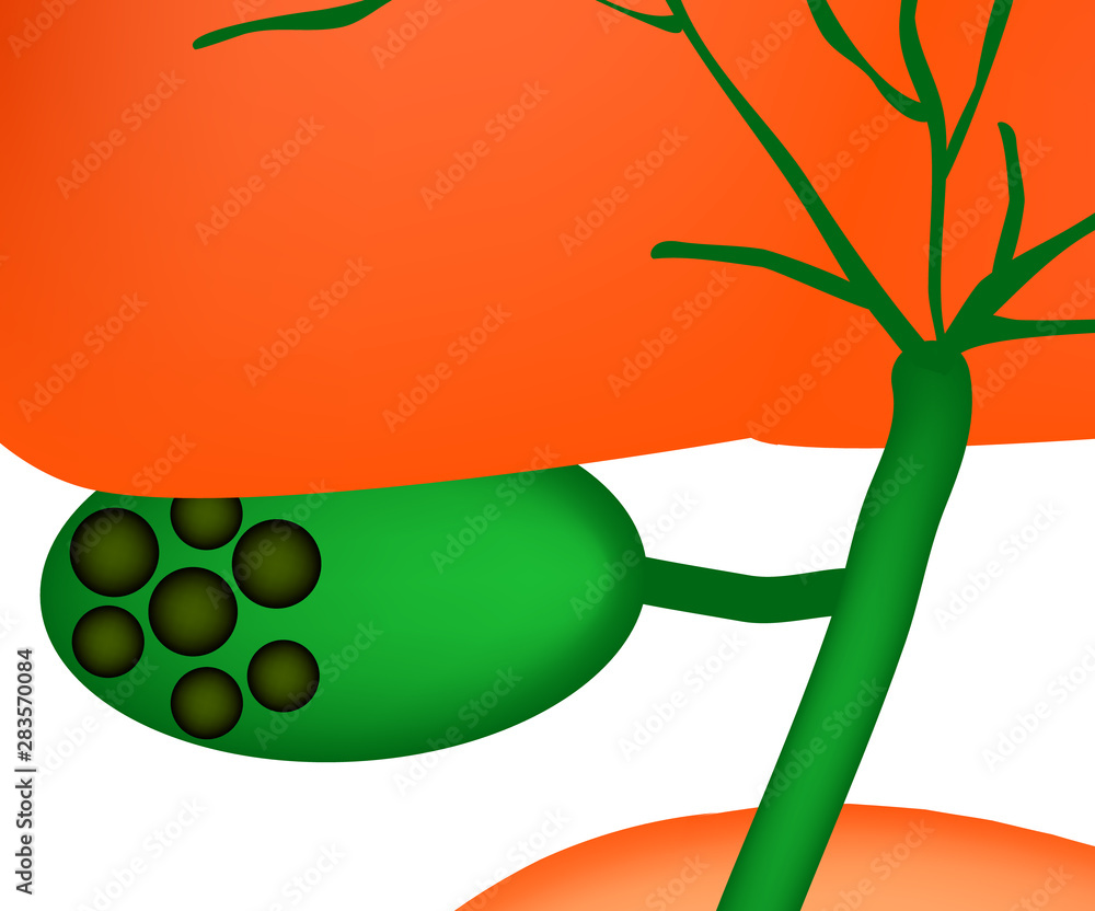 The stones in the gallbladder. Duodenum, pancreas, bile ducts. Vector ...