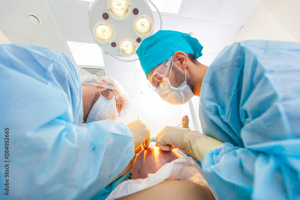 Baldness treatment. Hair transplant. Surgeons in the operating room ...