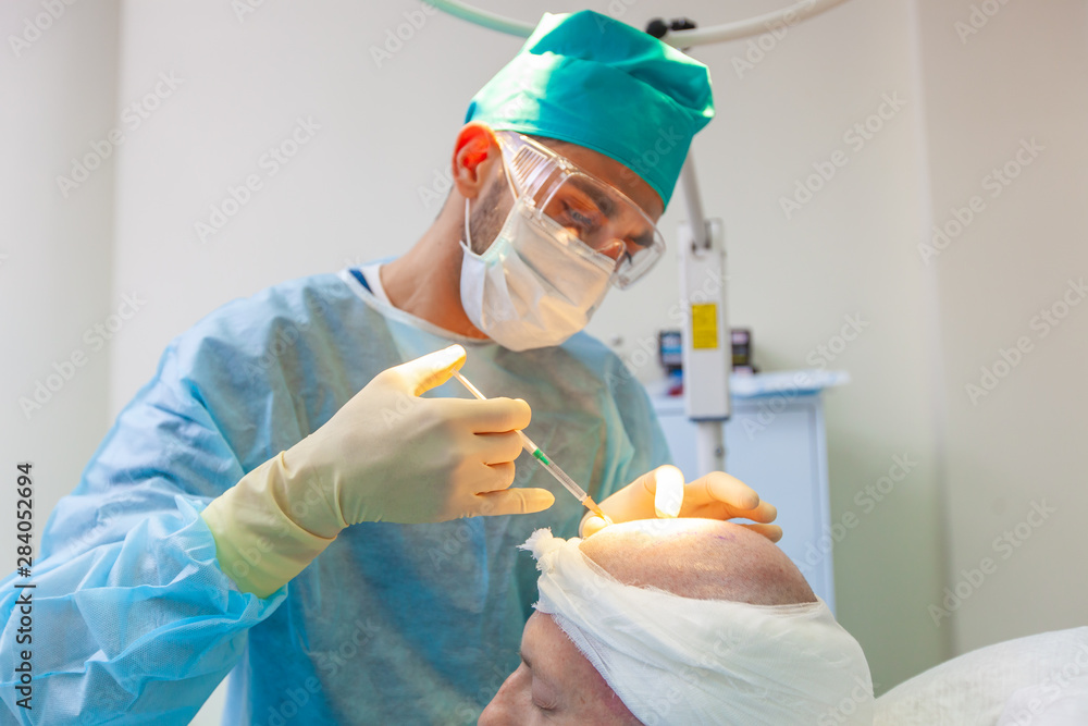 The surgeon gives injections to the head. Baldness treatment. Hair ...