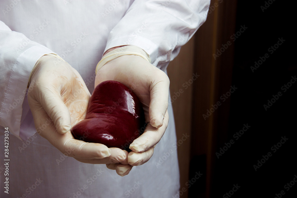 kidney transplant surgery concept. real kidney is in hands of ...