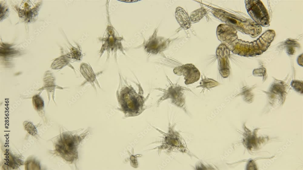 Black Sea plankton and zooplankton under a microscope, the diversity of ...
