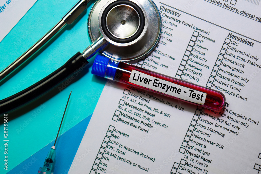 Liver Enzyme - Test with blood sample. Top view isolated on office desk ...