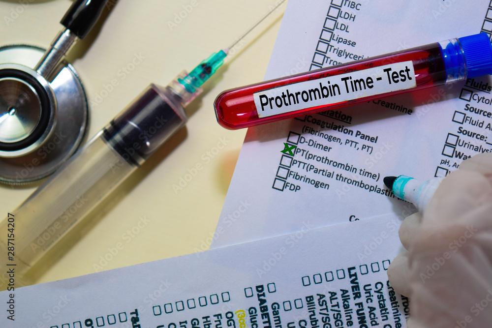 Prothrombin Time - Test with blood sample. Top view isolated on office ...