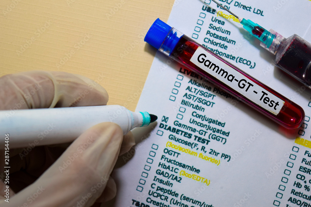 Gamma-GT - Test with blood sample. Top view isolated on office desk ...