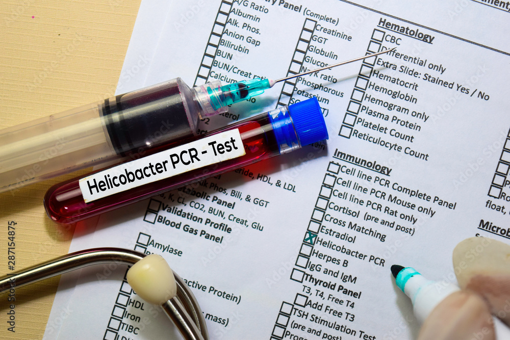 Helicobacter PCR - Test with blood sample. Top view isolated on office ...