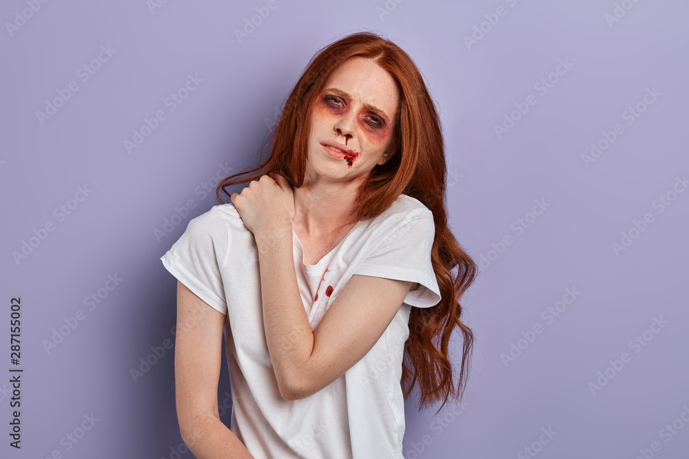 beaten injured girl has a pain in her shoulder, shoulder dislocation ...
