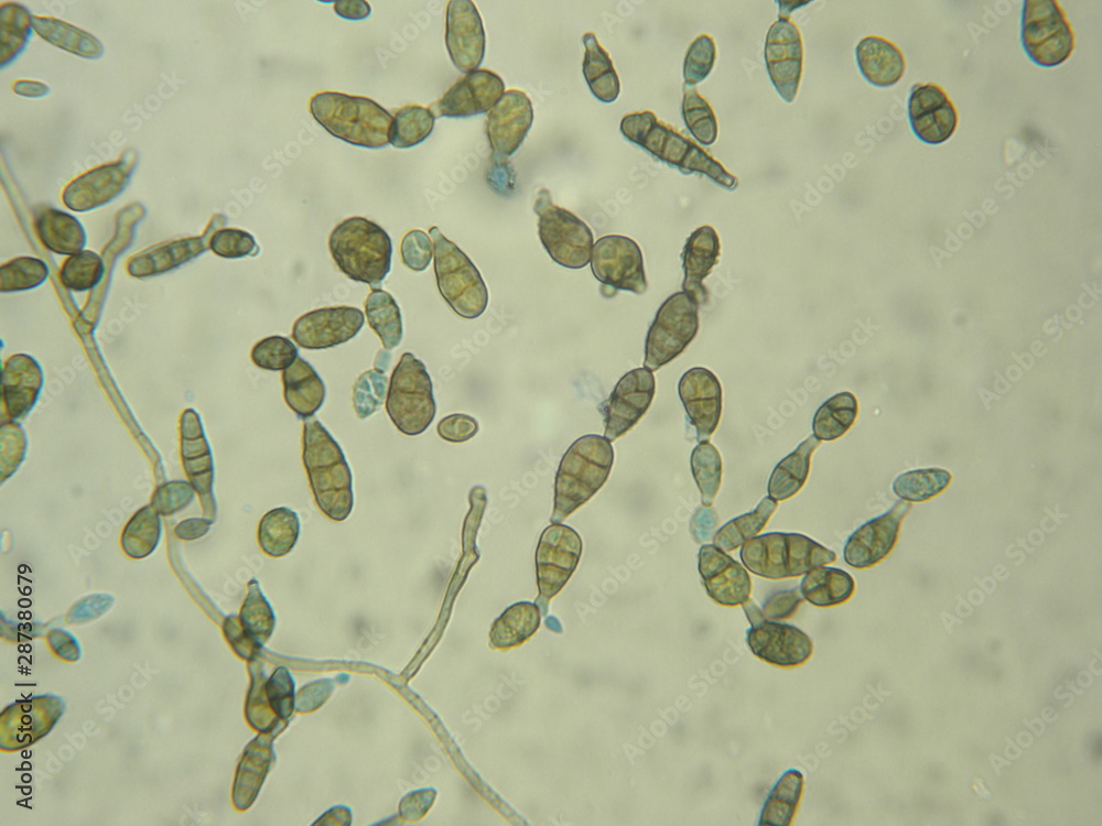 Alternaria sp. foto de Stock | Adobe Stock